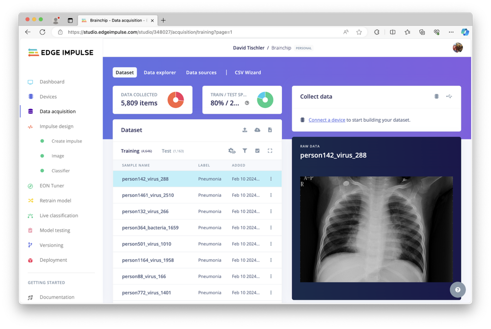 Classifying Medical Imaging On-Device with Edge Impulse and BrainChip